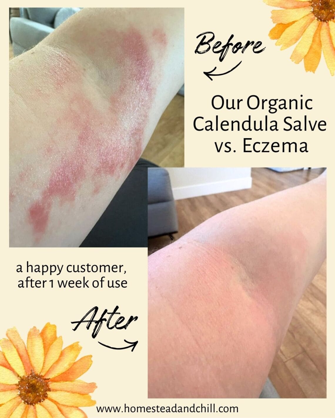 Organic Calendula Salve (Soothe Any Skin Issue!) ~ Homestead and Chill